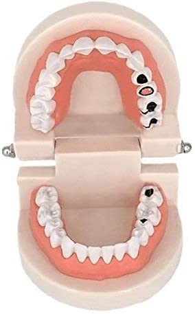 Easyinsmile lazy tooth model *standard tooth teaching model *sick tooth ...